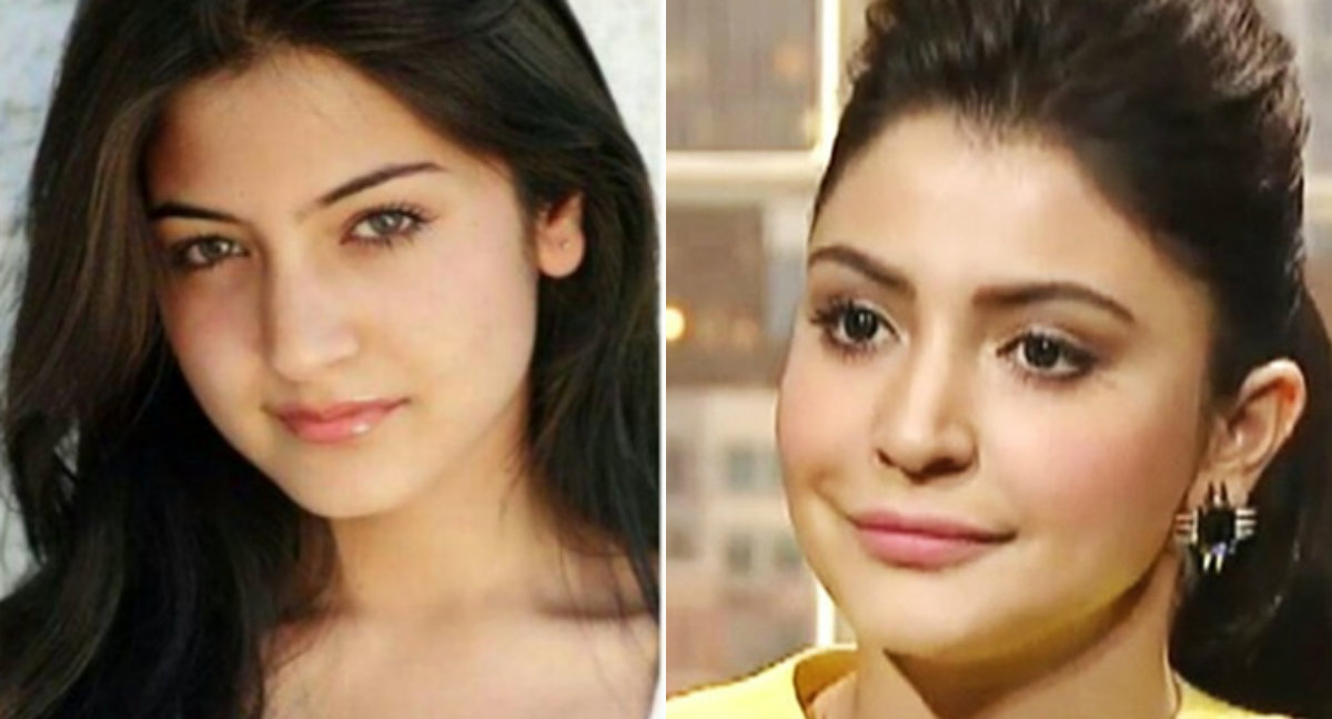 Bollywood Actresses who went under the knife to become gorgeous