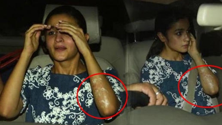 Bollywood celebrities who escaped near death | Bollywood Bubble