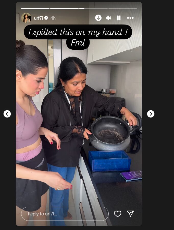 Uorfi Javed burns her hand from hot water- Watch